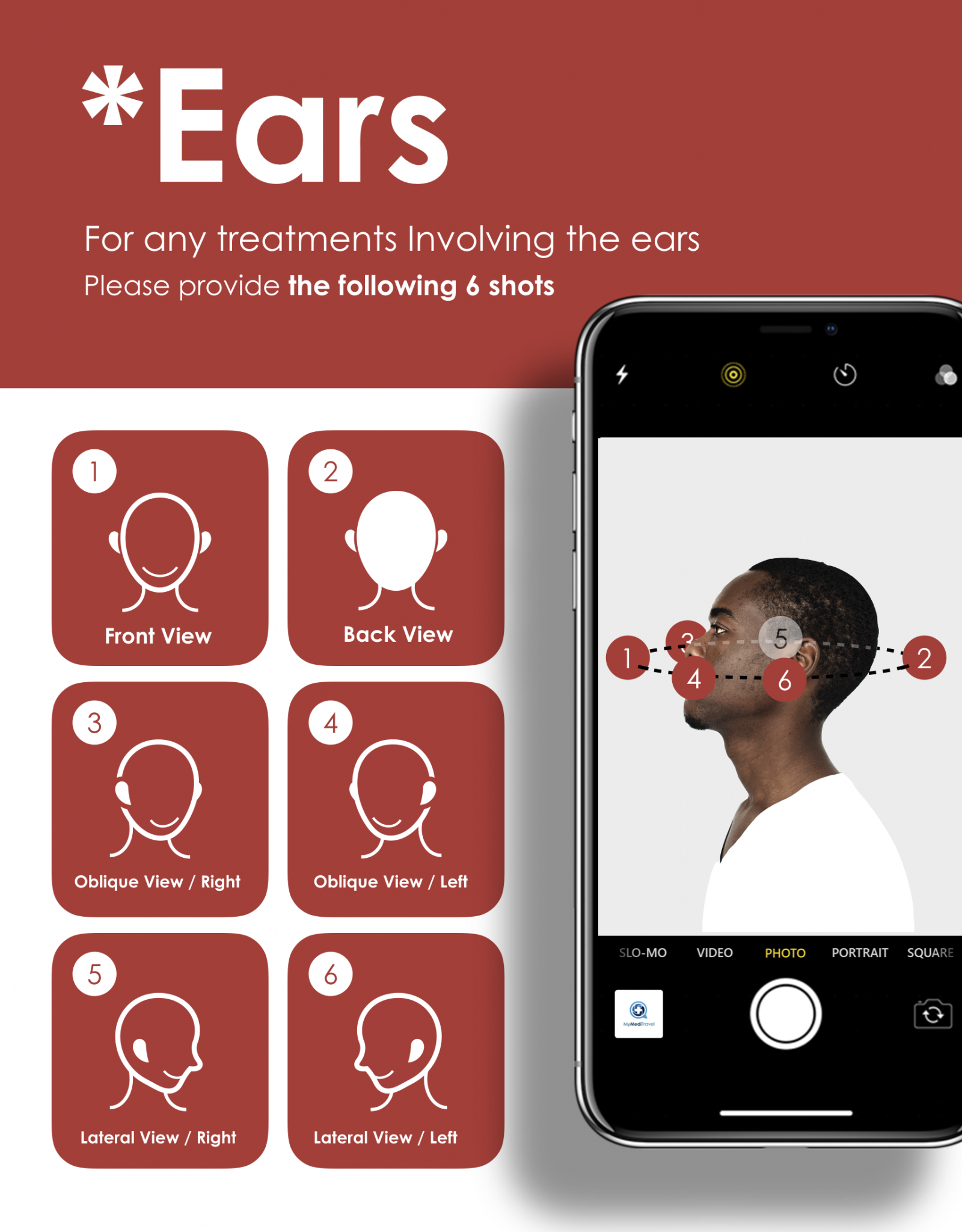 Photo Guide: Ears - MyMediTravel Knowledge
