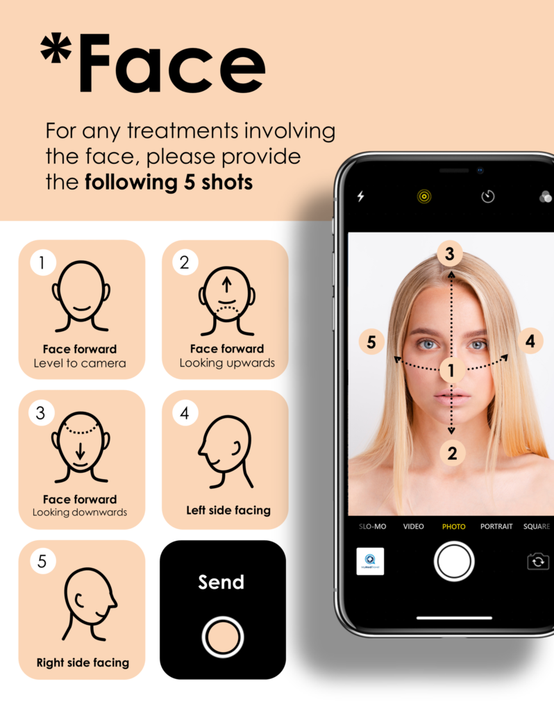 Photo Guide: Face - MyMediTravel Knowledge